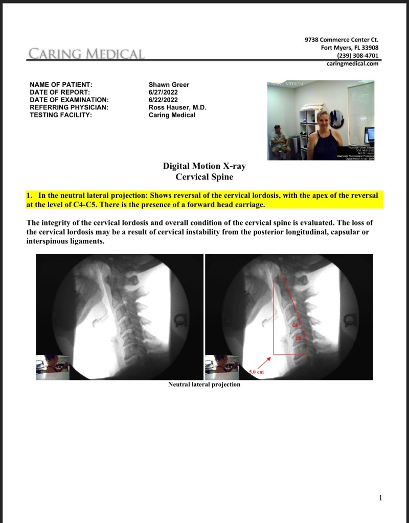 Digital Motion X-Ray – PhilippiJoy