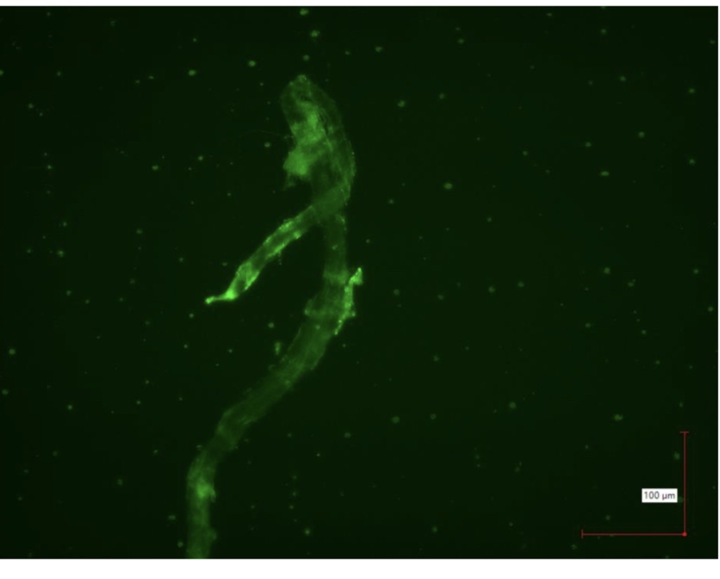 Blood Test Results – PhilippiJoy