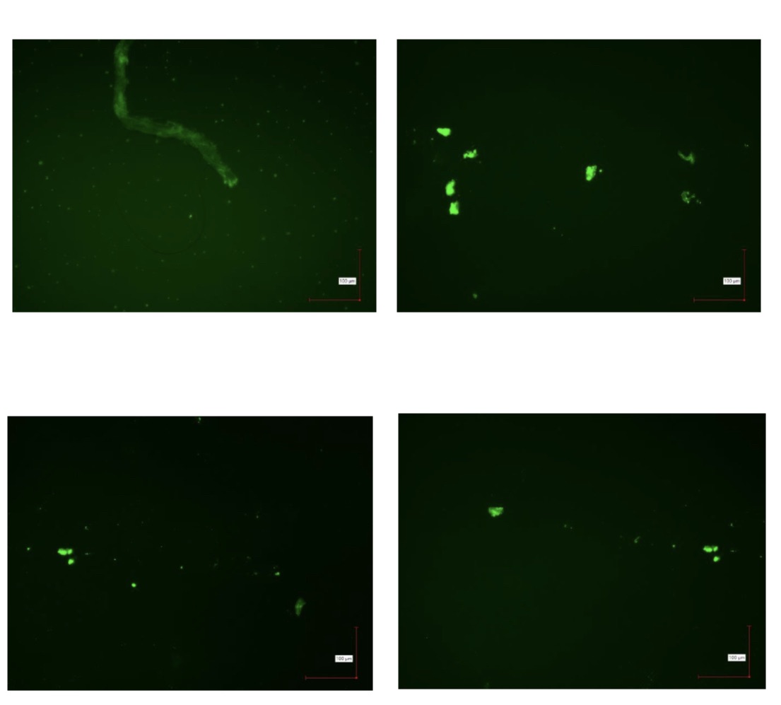 Blood Test Results – PhilippiJoy