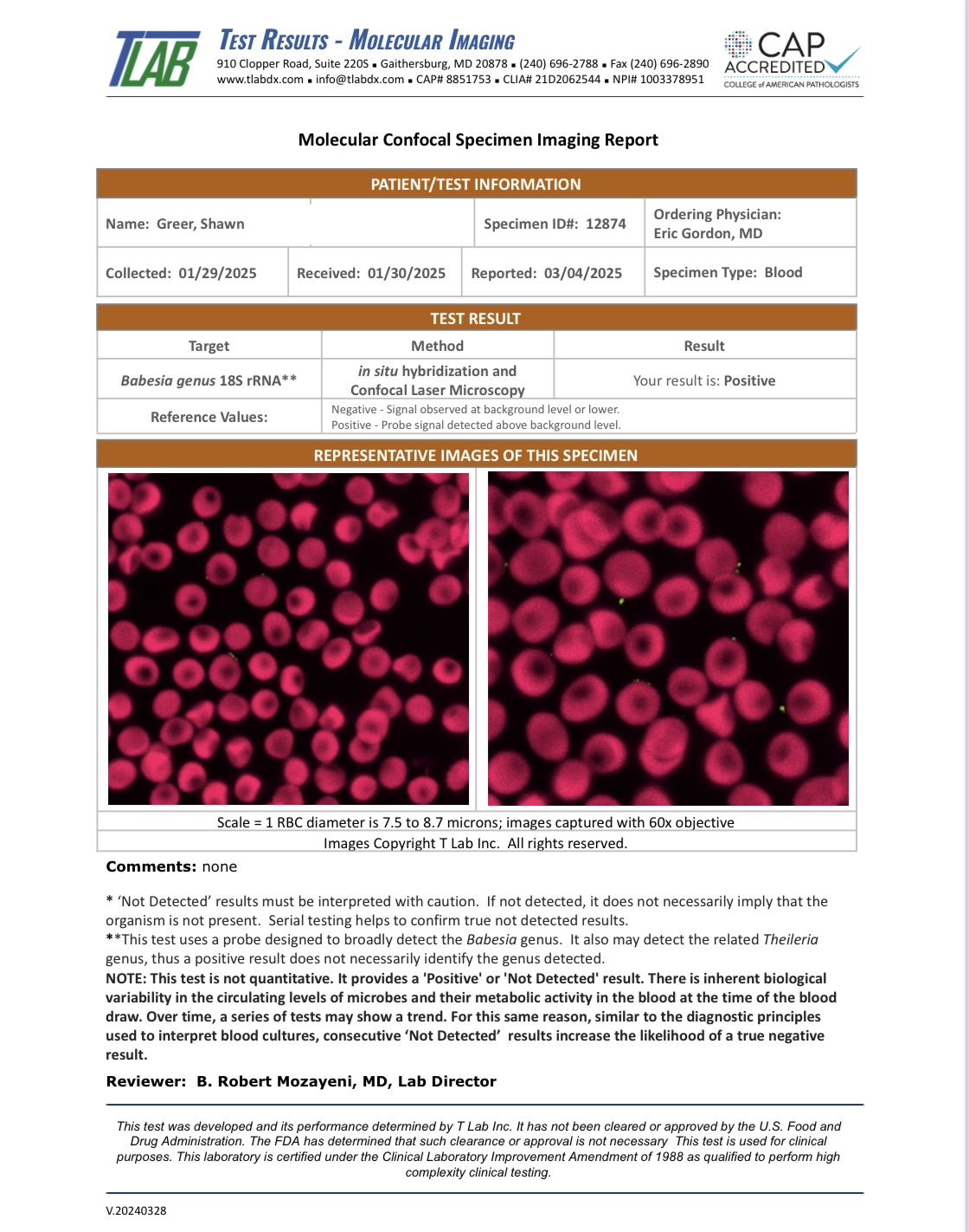 Blood Test Results – PhilippiJoy